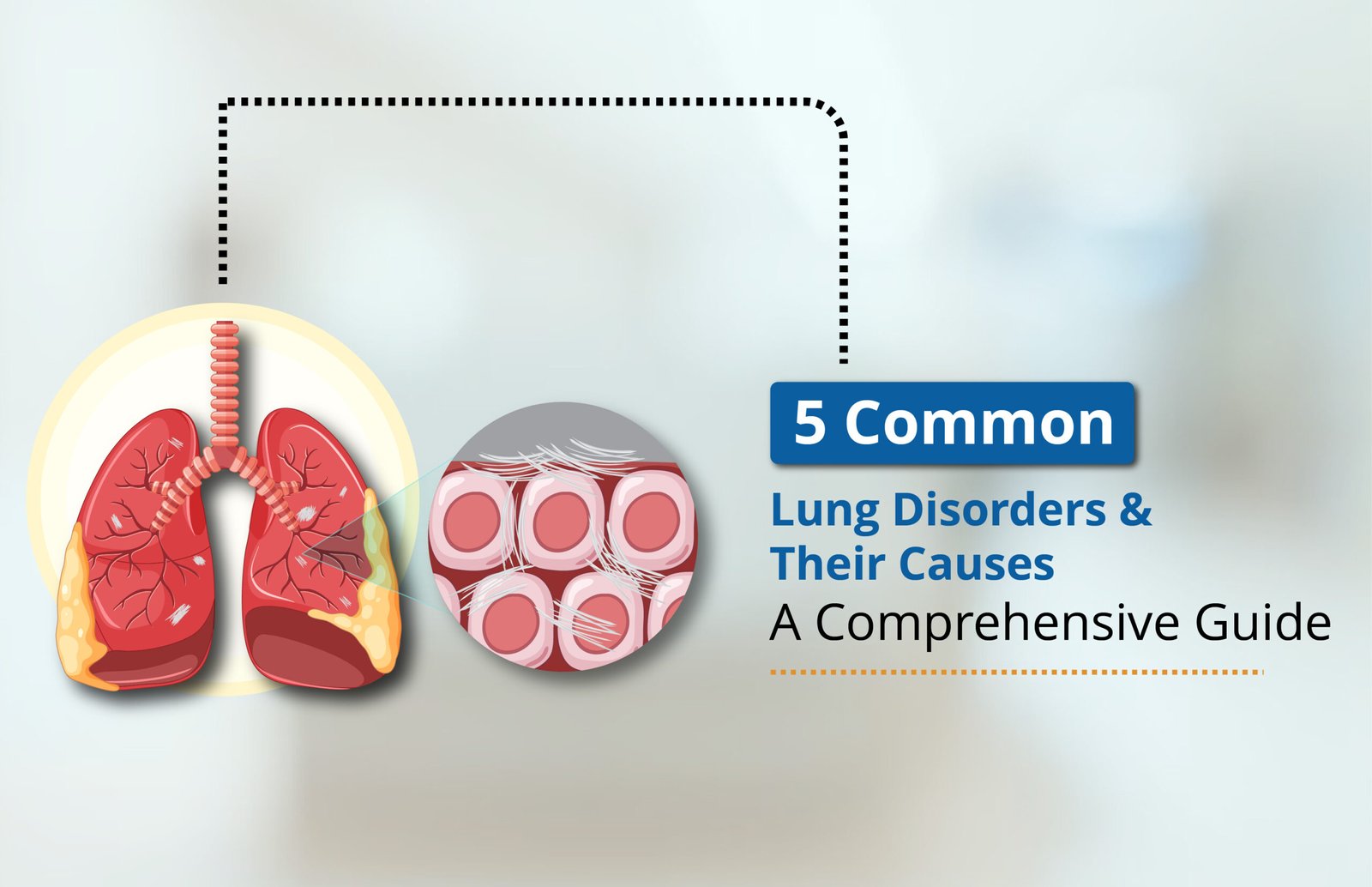 5 Common Lung Disorders - Causes and Treatment Guide